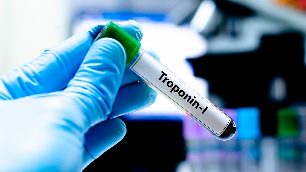 Troponina I | Lapi Laboratorio Médico